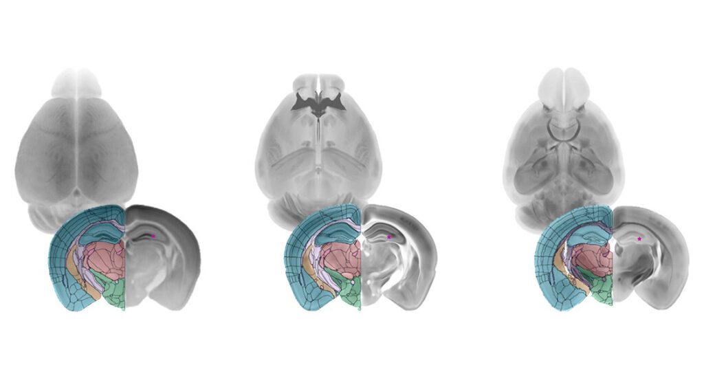 Multimodal 3d Mouse Brain Atlas Framework With The Skull Derived